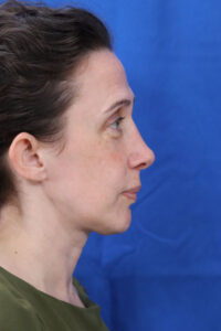 Dr. Alexander Slocum | New Hampshire's Best Plastic Surgeon