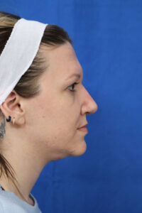 Dr. Alexander Slocum | New Hampshire's Best Plastic Surgeon
